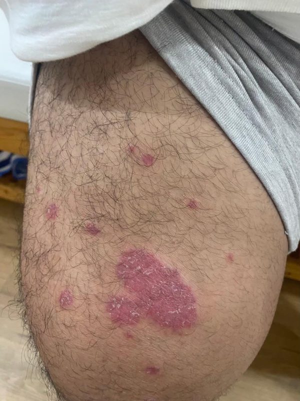 Traditional Thai Chiropractic Bone Adjustment – Chujai Thai Traditional ...